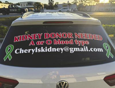 Coworkers bond over life-saving kidney donation | Local News ...