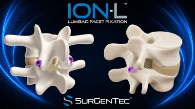 SurGenTec® Receives FDA Clearance for ION-L™, a Novel Lumbar Facet ...