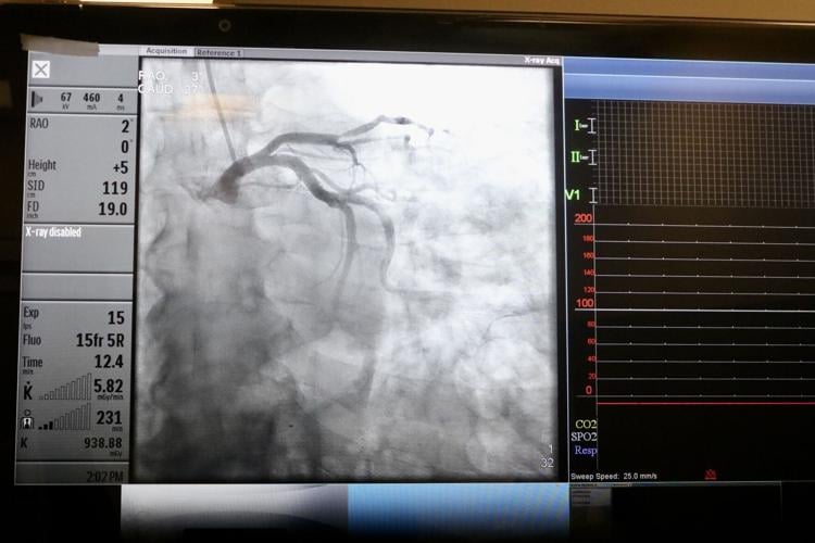 Heart catheterization services return to Sharon Regional | Local News ...