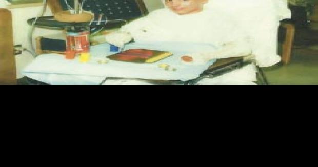 Photos, Story: After near-fatal accident 25 years ago, burn victim ...