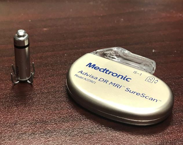 New mini-pacer replaces some pacemakers for heart patients | Local News ...