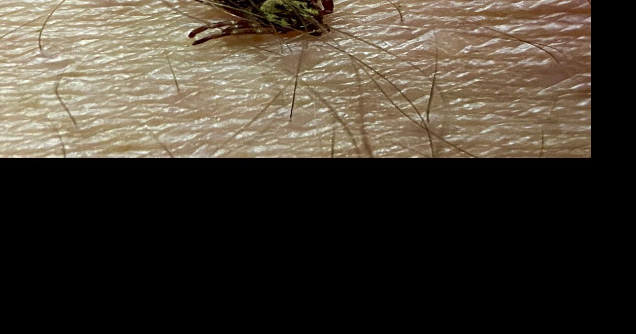 The health issues of ticks | Community Columns | newportplaintalk.com