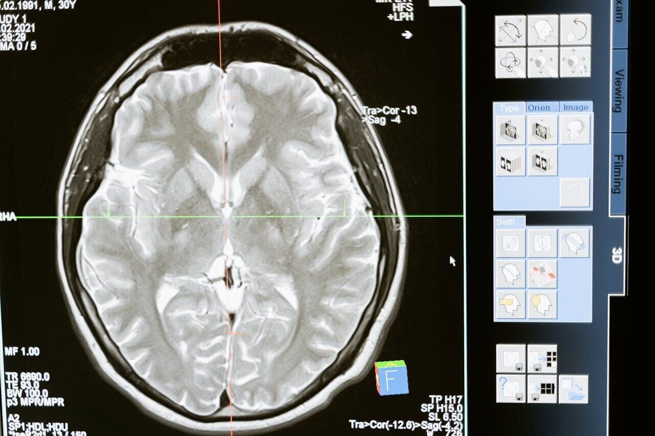Vaccine offers new hope against incurable brain cancer | Health | news ...