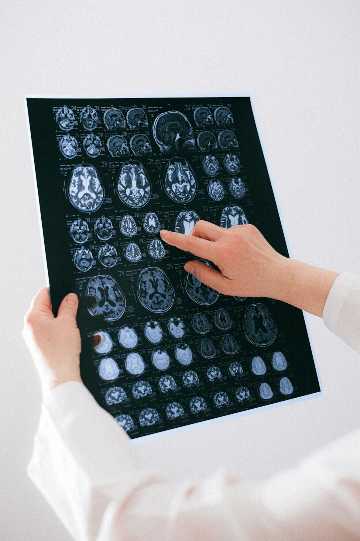 Vaccine offers new hope against incurable brain cancer | Health | news ...