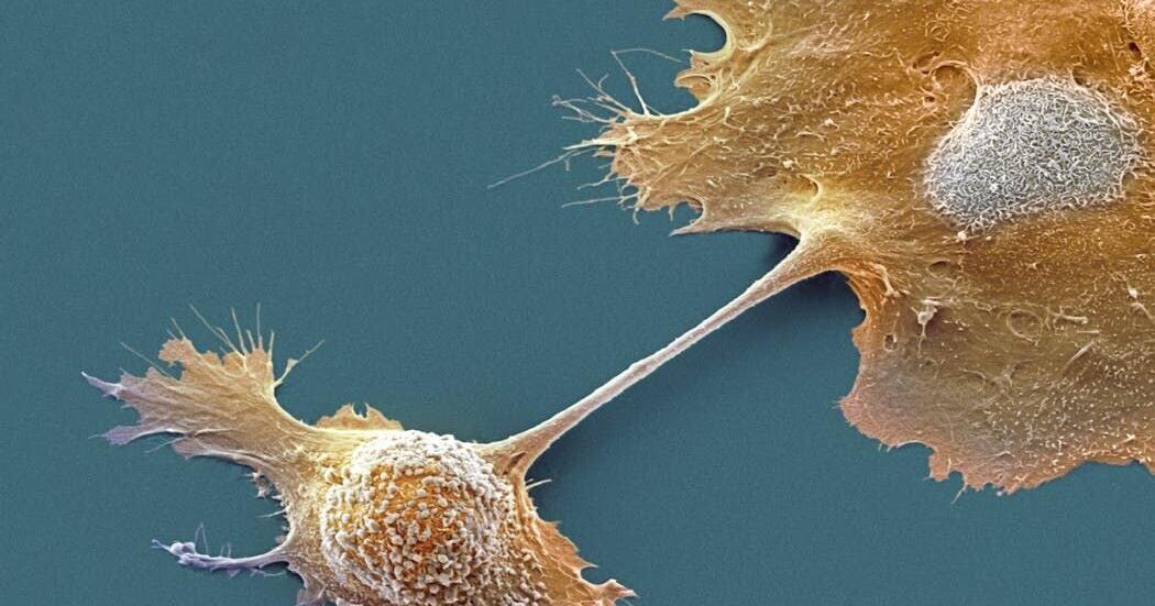 Breakthrough drug nearly doubles survival with advanced pancreatic ...