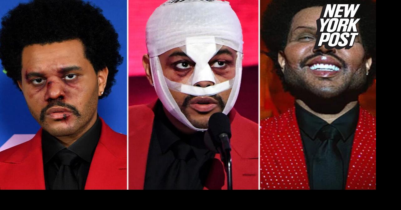 Secrets of The Weeknd's face, from bloody horror to 'surgery' shocker