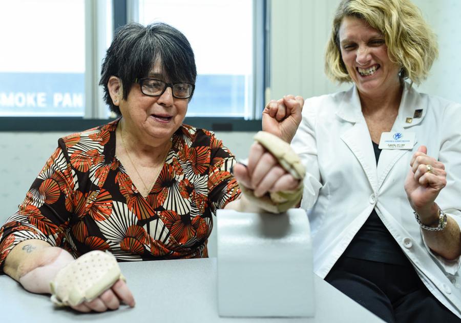 Technology To Grasp Woman Recovering From Double Hand Transplant