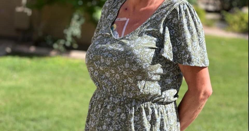 Dr. Elizabeth 'Beth' (Anderson) Burkhardt | Obituaries | newsitem.com