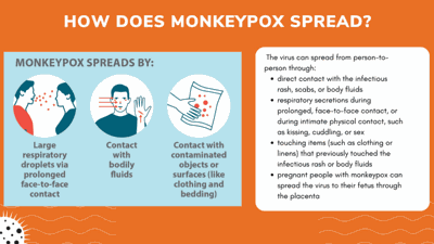 Orange County has its first reported case of Monkeypox | Community ...