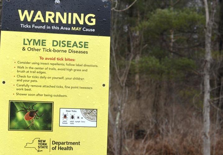 Tick, tick, tick: Expert worries tick problems could explode this year ...