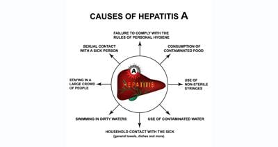 hepatitis a causes