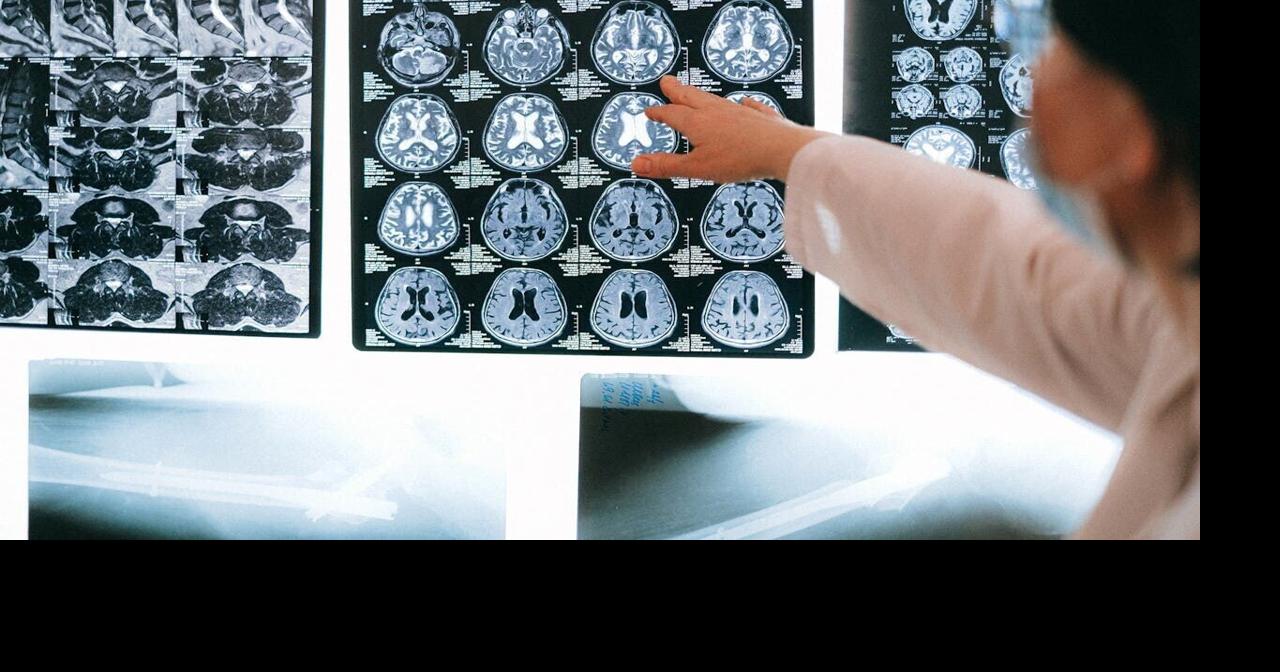 Half of patients with depression improve with deep brain stimulation ...