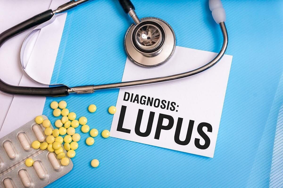 Mystery Cause Of Lupus Revealed, Experts Say | Health | northwestsignal.net