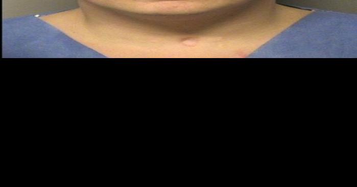 Police: Portage man charged with DUI cited in 3 accidents