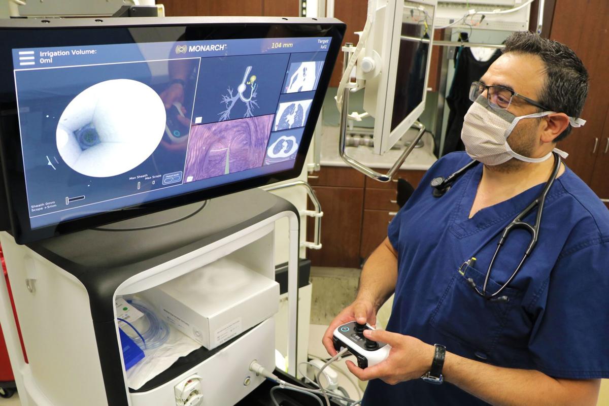 Community Hospital fourth in state to add new lung cancer detection ...