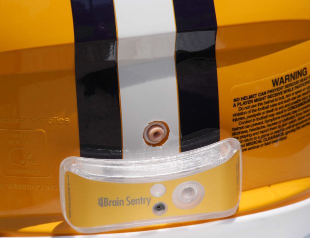 Brain Sentry helmet sensor helps identify possible concussions