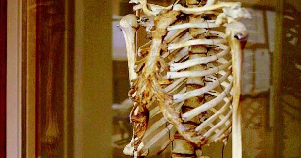 Full skeleton discovered in hospital basement to go on display at ORHC ...