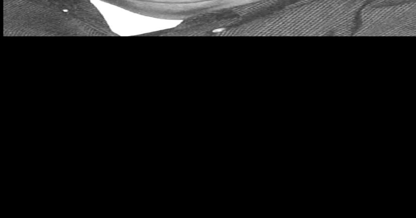 Raymond 'Butch' Lambert | Obituaries | paducahsun.com