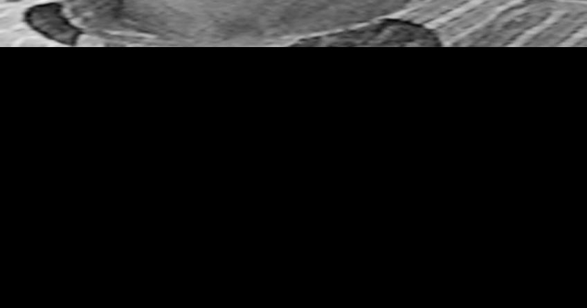 Larry Brantley Champion, Sr. | Obituaries | paducahsun.com