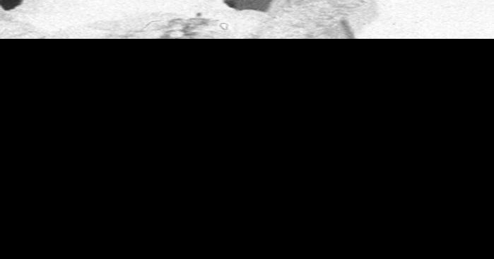 50th for Harold, Kay Lindley