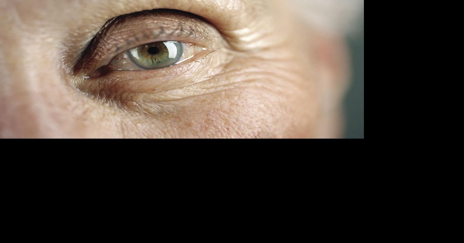 RCH-July is “Dry-Eye Month” | Business | paysonroundup.com