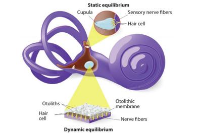 loose crystals causing vertigo