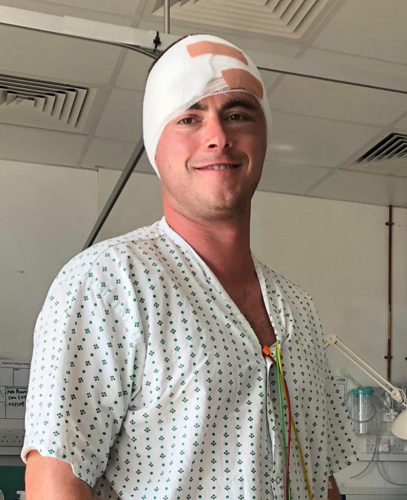 Man’s numbness on right side of body was sign of deadly brain tumor ...