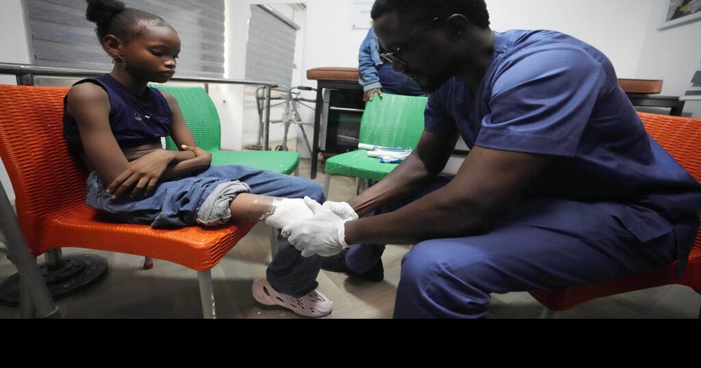 Nigerian group provides hundreds of prosthetic limbs to amputee ...