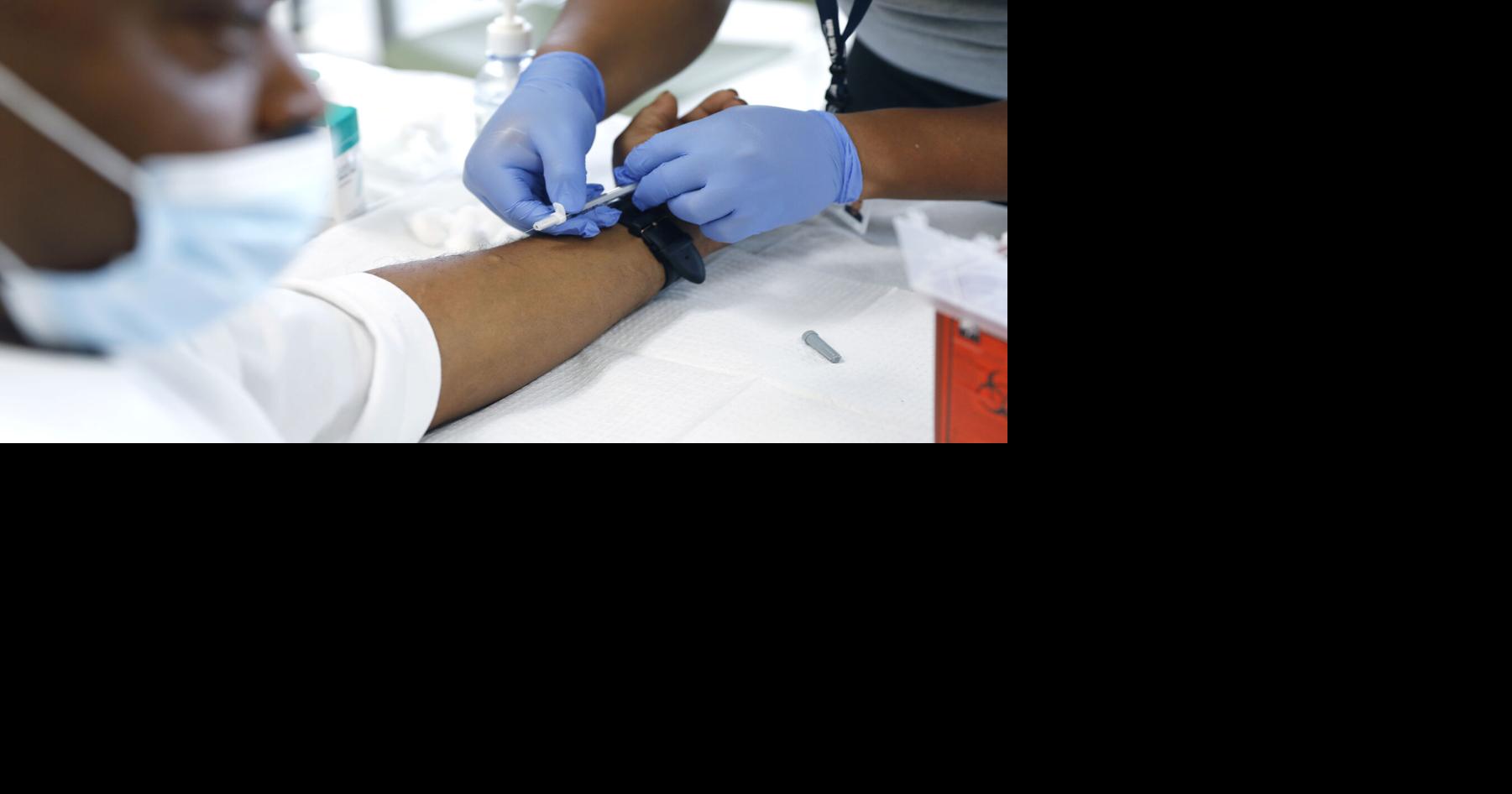 Blacks, Hispanics more likely to get monkeypox but less likely to be ...