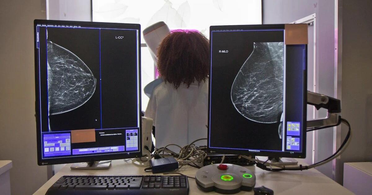 Missing the first mammogram linked to increased risk of breast cancer ...