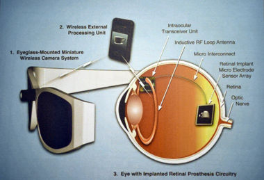 Giving sight back to the blind | Health And Wellness | pinalcentral.com