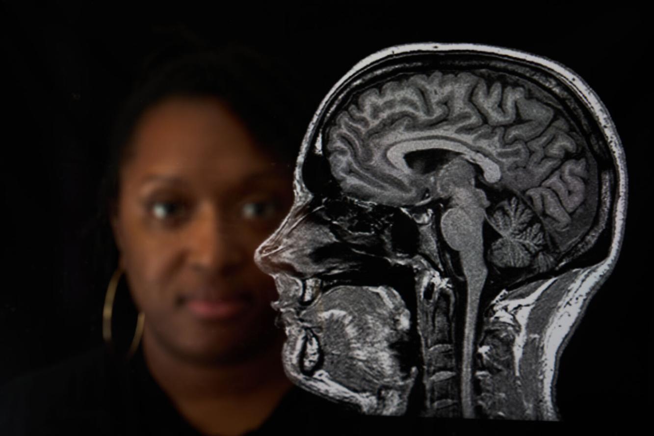 Autoimmune Diseases Brain | National News | postregister.com