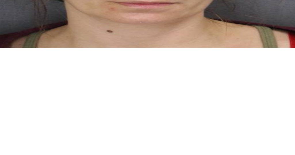 Vermont woman expected to receive 5 years in prison for drug, bail jumping charges