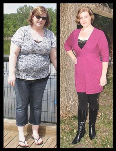 Surgery solves rapid weight gain issue | News | presspubs.com