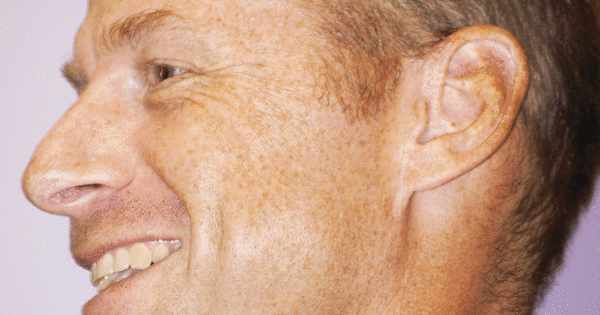 Timber bid opening exceeds $800,000 | News | presspubs.com