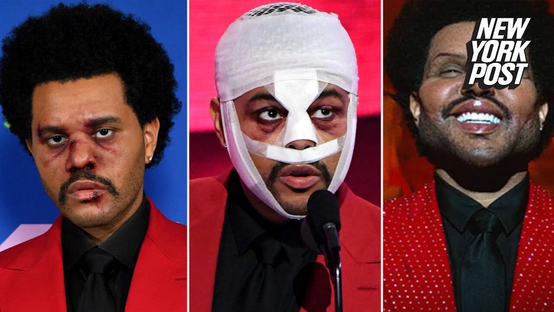 Secrets of The Weeknd's face, from bloody horror to 'surgery' shocker ...