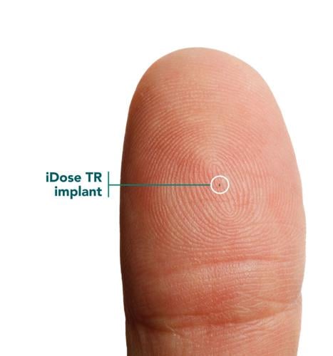 Eye Surgeons Associates: Sustained drug delivery implants to treat glaucoma