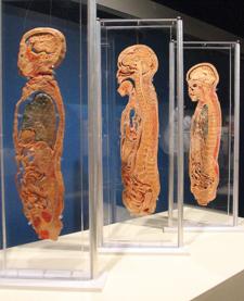 "Bodies Revealed" exhibit