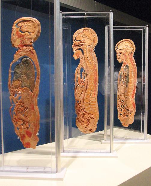 "Bodies Revealed" exhibit