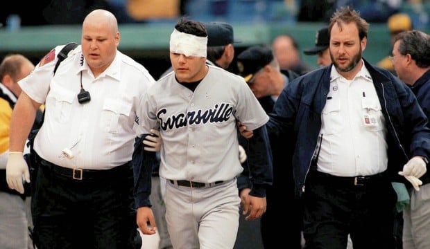 A decade after blinding pitch, Anthony Molina says he misses the ...