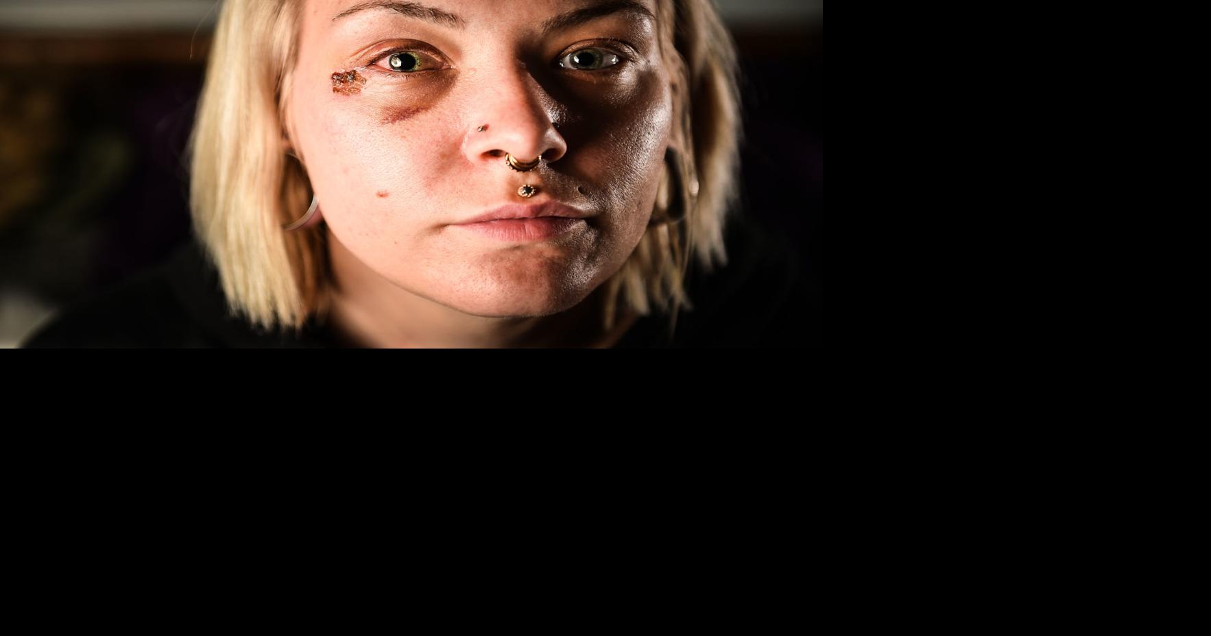 Davenport woman struck by paintball has permanent eye damage