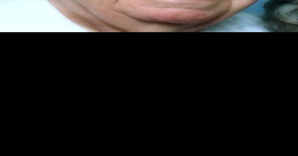 Alvis “Al” M. Taylor