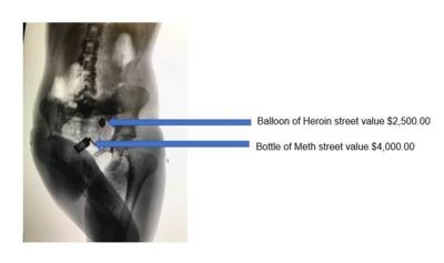 Body scanners preventing contraband in state jails | Crime | register ...