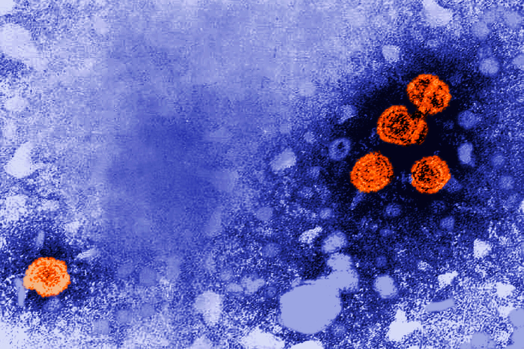 US awards no-bid contract to Denmark scientists studying hepatitis B ...