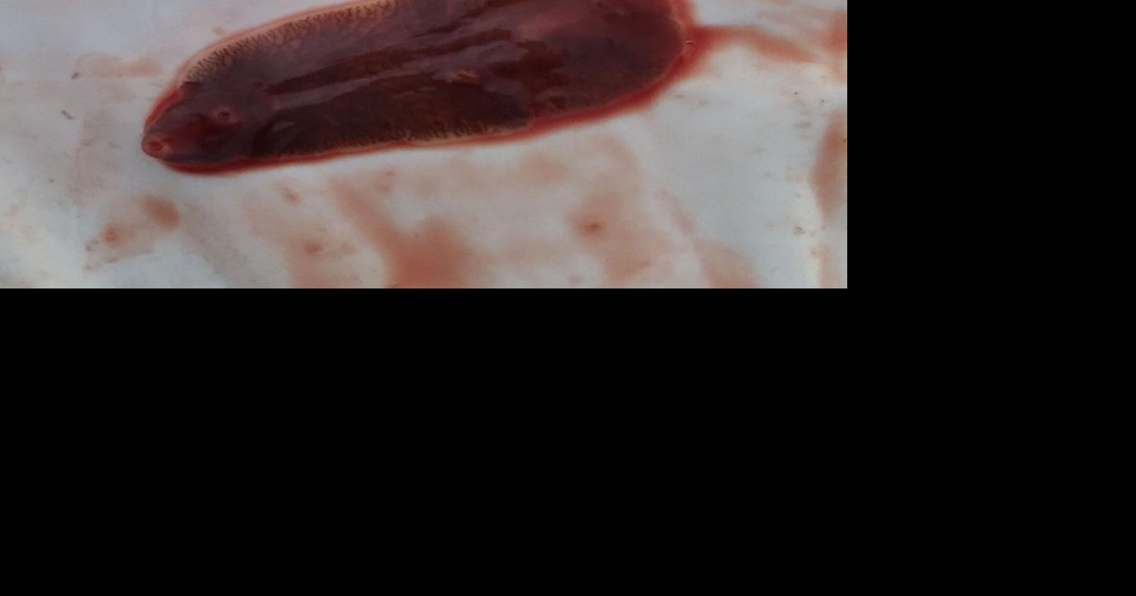 UVM Extension: Liver fluke alert | Weekend Magazine | rutlandherald.com