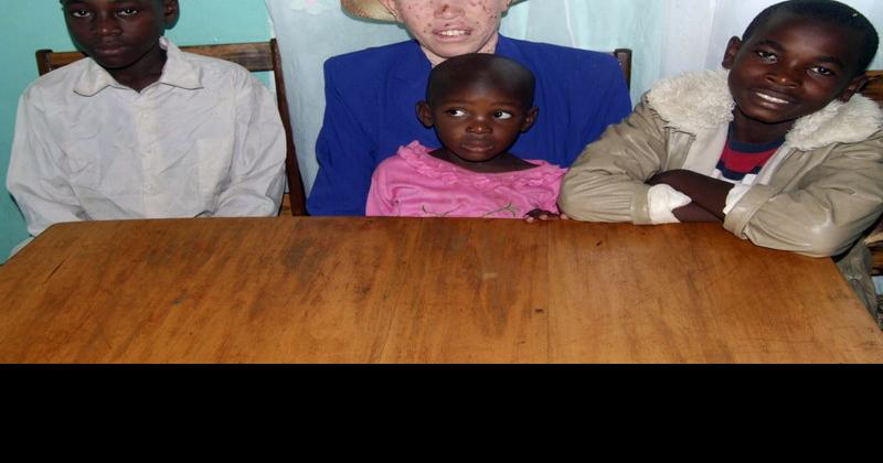 10,000 East African albinos in hiding after mass killings | News ...