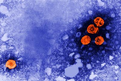 Experimental hepatitis B drug may offer 'functional cure' for some ...