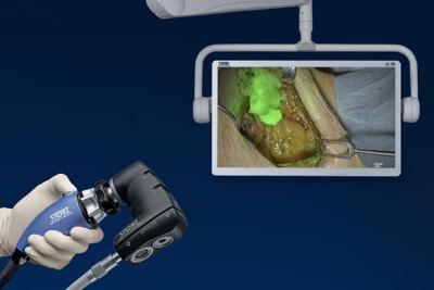 KARL STORZ Announces FDA Clearance for Rubina Lens for Open Surgery ...