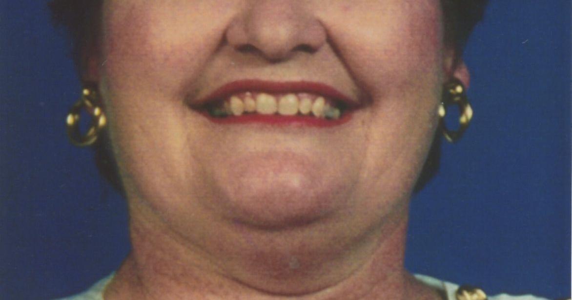 Carolyn May Schmidt | Obituaries | seguingazette.com