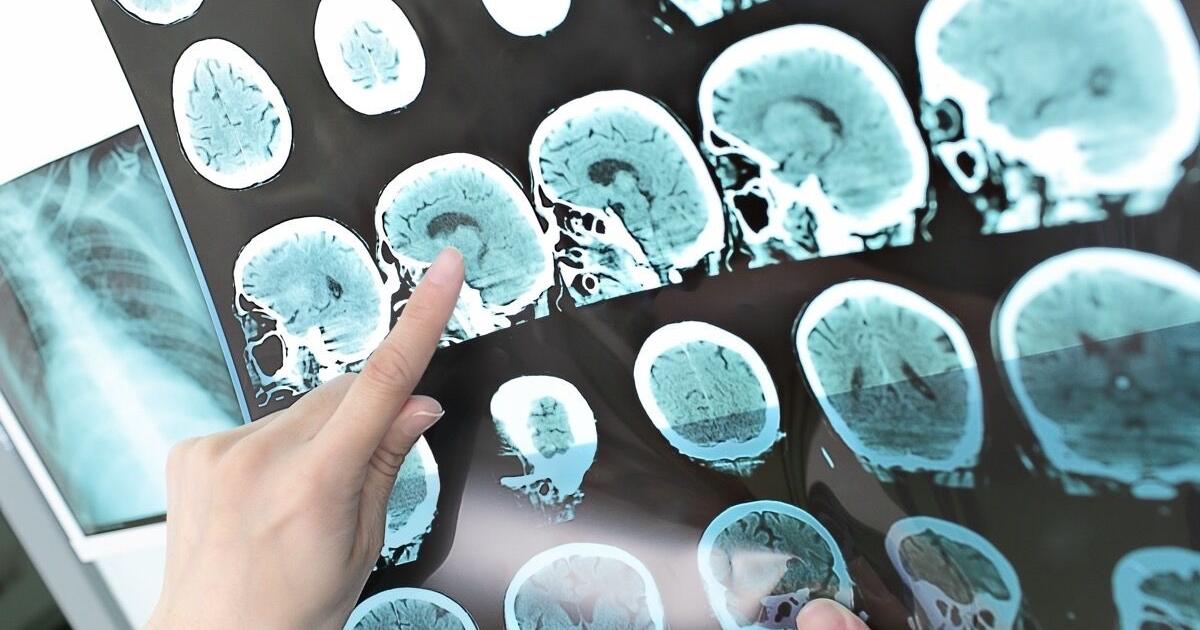 Jahi McMath and the ongoing legal battle around brain death ...